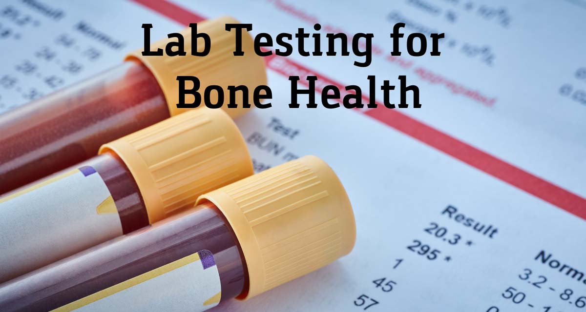 Lab Tests for Bone Health - Nurtured Bones